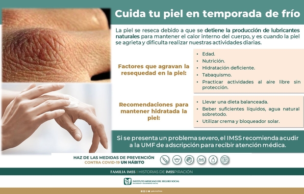 Recomienda IMSS Chihuahua mantener hidratada la piel en esta temporada ... Recomienda IMSS Chihuahua mantener hidratada la piel en esta temporada ...
